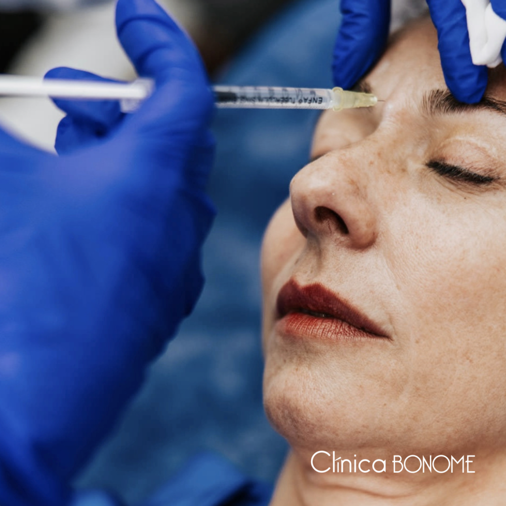 TOXINA BOTULÍNICA + ÁCIDO HIALURÒNICO - Clínica Bonome